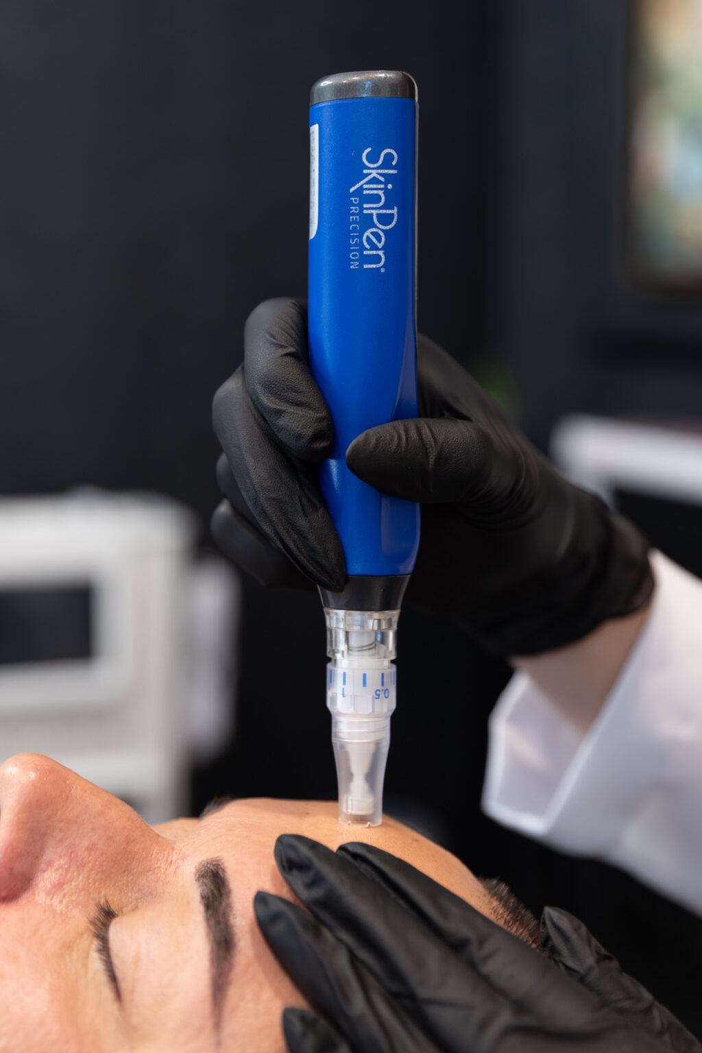 Microneedling in Memphis | Glo Medical Aesthetics